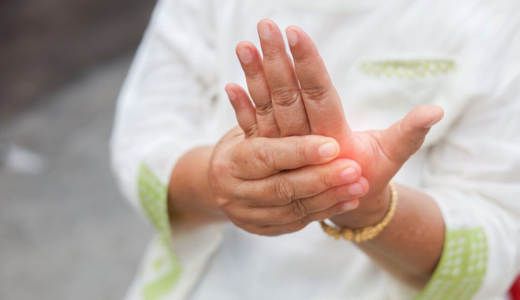 Fingerarthrose behandeln - Schmerzlinderung & Beweglichkeit ...
